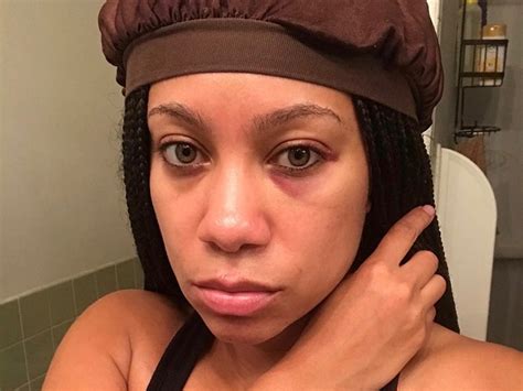 Dray Clarks Girlfriend Comes Forward About Domestic Violence In Facebook Post