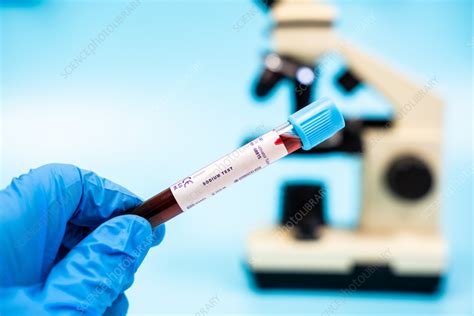 Sodium Test Stock Image F Science Photo Library