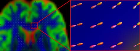 Mrtrix Introduction Overview Of Diffusion Imaging — Andys Brain Book