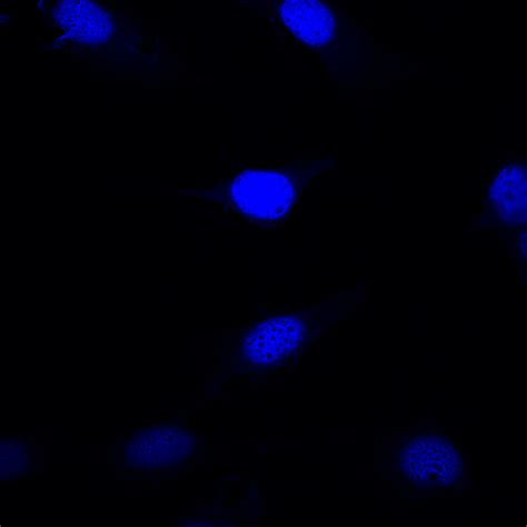 What Is The Meaning Of Big Black Dots Which Seems To Be Dapi Negative In A Dapi Stained