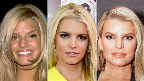 Did Jessica Simpson Get Plastic Surgery Transformation Photos Life And Style