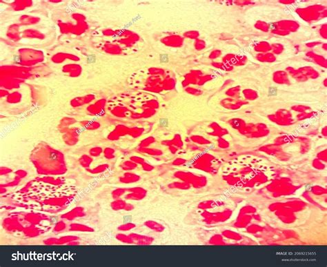 3 Neisseria Gonorrhoeae Gonococcus Gram Negative Diplococci Bacteria