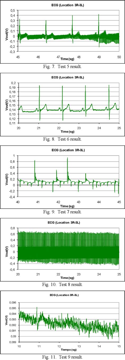 Figure 11 From Unobtrusive Contactless Cardiac Monitoring For Telemedicine And Ambient Assisted
