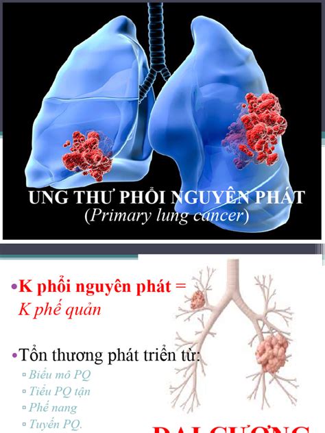 K Phổi Nguyên Phát Pdf