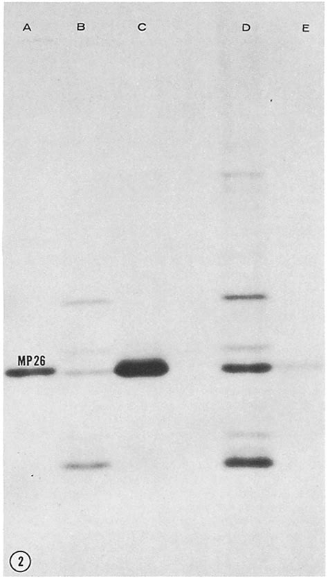 Cotranslational Integration Of Mp26 Into Microsomal Membranes