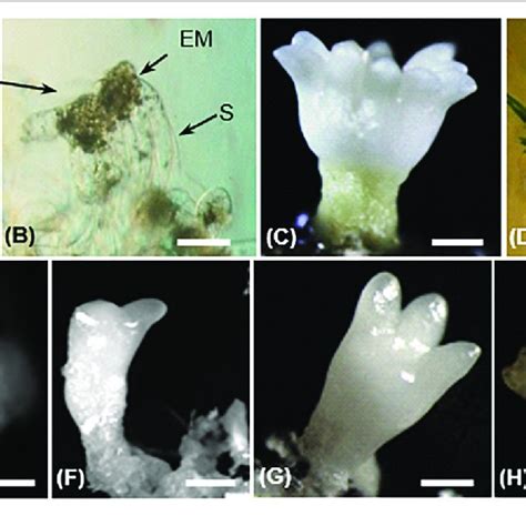Different Steps Of Somatic Embryo Se Development In Pinus Pinaster