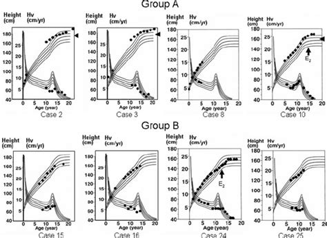 growth charts of eight cases plotted on the sex matched longitudinal