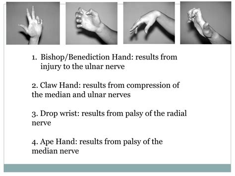 Ppt Wrist And Hand Powerpoint Presentation Free Download Id2317152