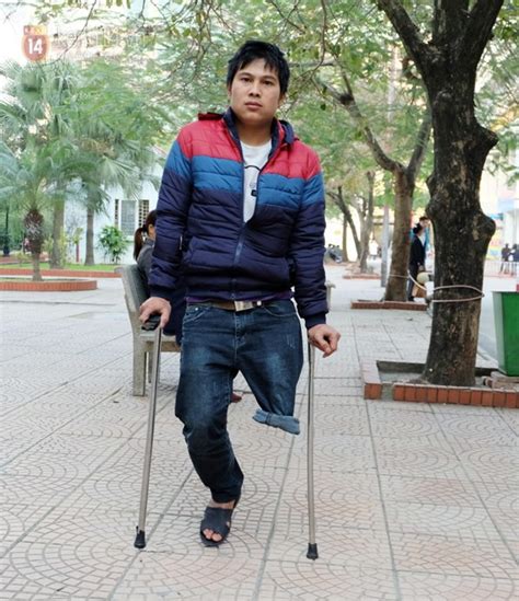 Cha Cụt Chân Chống Nạng Chăm Con 10 Tuổi Bị Bạn Châm Lửa đốt Bỏng Nặng