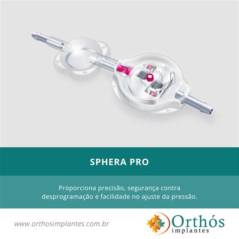 A Sphera Pro é Um Sistema De Derivação Orthós Implantes