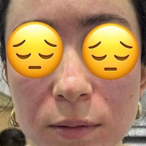 Dr Cansu Şahin Şikayetvar