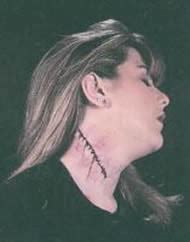 Stitches Application
