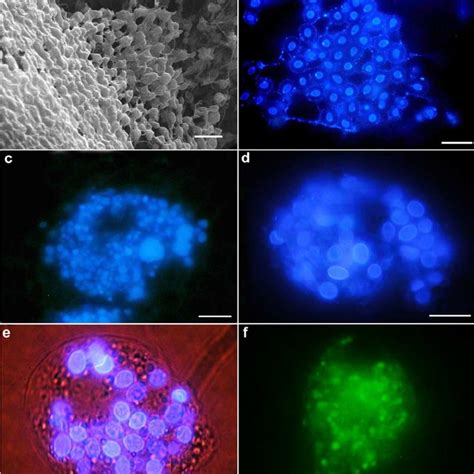 Photomicrographs Of 3 Day Old Cryptococcus Laurentii Biofilms Viewed