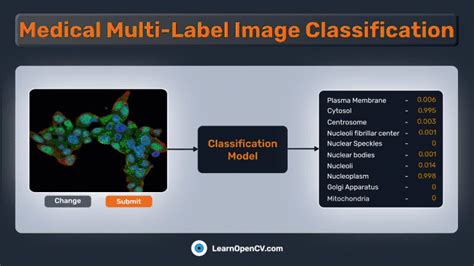 Loïc Lauréote On Linkedin Enhancing Medical Multi Label Image