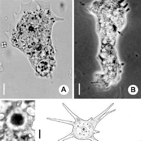 Multiple Infections With Amoebophilus Simplex In Mayorella