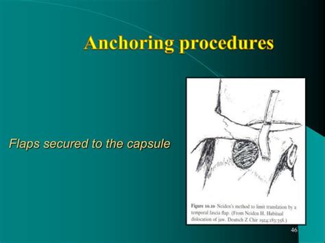 Tmj Dislocation And Its Managementpptx