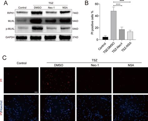 Effects Of Necroptosis Inhibition On Nsc Death After Tsz Treatment In
