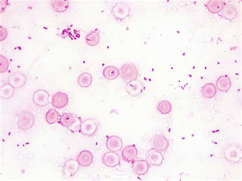 Gram Stain Itm Labhub