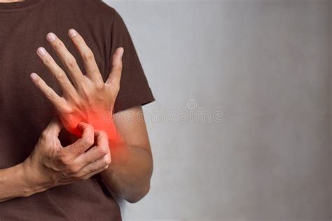 Asian Man Scratching His Hand Concept Of Itchy Skin Diseases Such As
