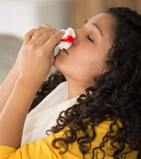 Nose Bleeding Causes While Sleeping