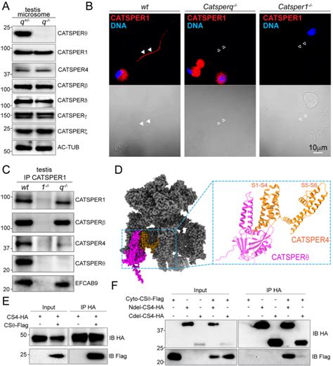 Catsperq Loss Of Function Compromises Catsper4 Assembly Into Catsper Download Scientific Catsperq Loss Of Function Compromises Catsper4 Assembly Into Catsper Download Scientific