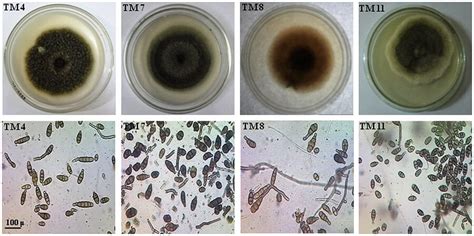 Alternaria Alternata An Overview