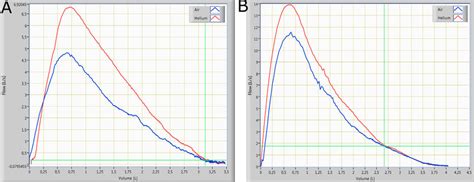 A Forced Expiratory Flow Volume Curves On Breathing Air Blue Curve Download Scientific