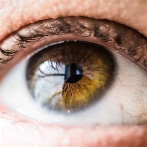 The Strange Connection Between Hyperacusis And Photophobia