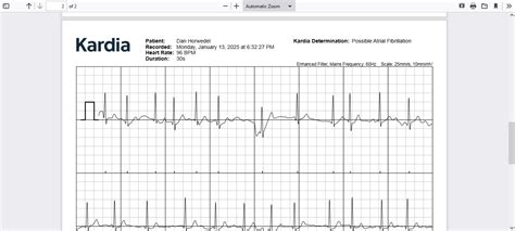 Everyday With Dan Afib Trigger