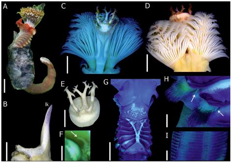Brasil On A New Species Of Spirobranchus Annelida Serpulidae And