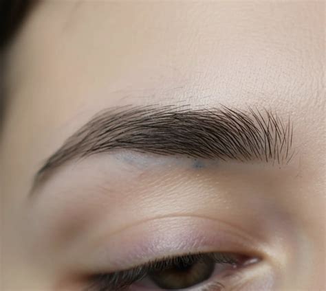 What Causes Pigment Migration