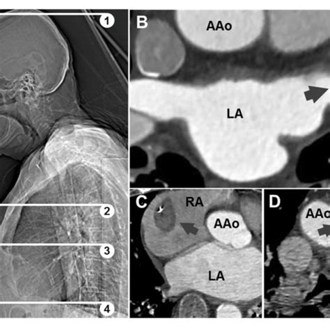 A Scout View Showing Scan Range Of Conventional 1 2 And Extended Download Scientific