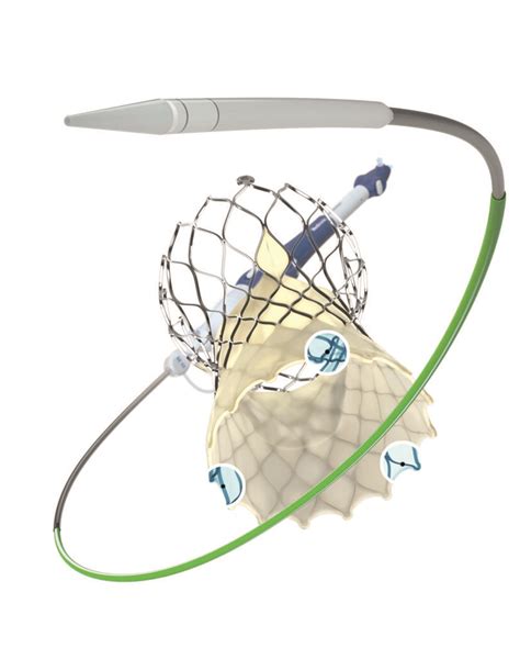 Evolut Tavi Systems Gain Us Fda Approval For Redo Tavi Procedures