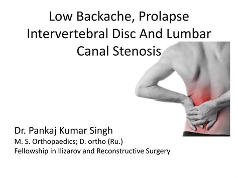 Prolapsed Intervertebral Disc Pptx