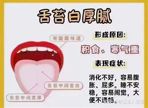 今天教大家辨认一下舌苔~ 很多非医人说，做了妈妈以后都能成为半个医生 好好关注我，做一个让孩子脾胃好少生病的养生好麻麻~ 知乎
