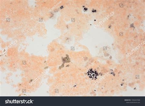 Mould Fungus Texture Detail