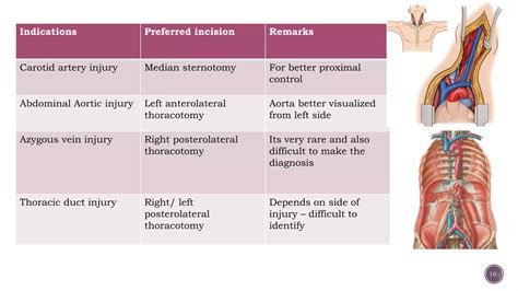 Incision And Chest Exposure In Emergency Pptx