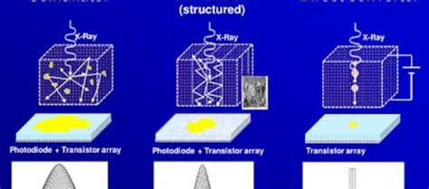 Latest News Commonwealth Radiology Associates