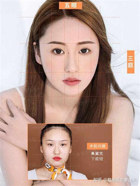 鼻子审美（六） 鼻部与面部的美学关系 知乎