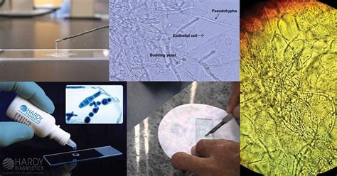 Koh Test Principle Media Procedure Results Uses
