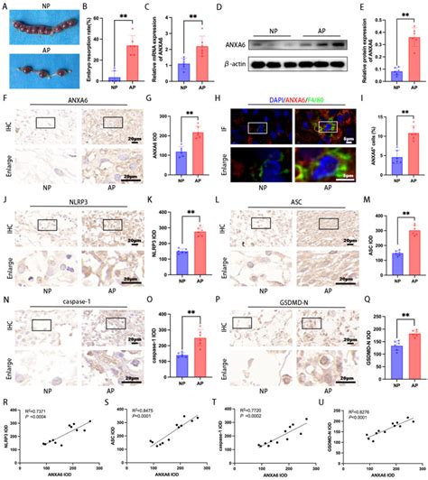 Anxa6 Overexpression Causes Abnormal Decidual Macrophage Trophoblast