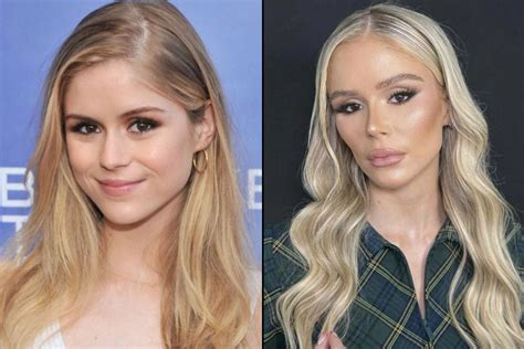 Best 12 Karoline Leavitts Transformation Has Ignited A Shady Plastic