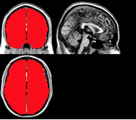 Data Processing Assistant For Resting State Fmri Dparsf The R Fmri Network