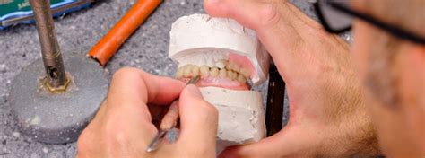 New Dentures Acrylic Sunflex Or Swiss Options Available The