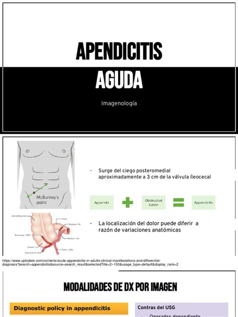 Apendicitis Aguda Pdf Enfermedades Y Trastornos Humanos Causas De