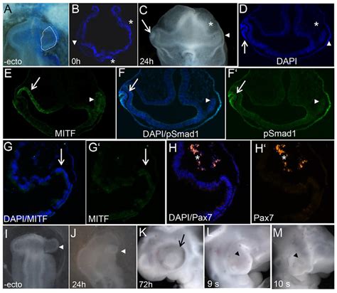 The Surface Ectoderm Is Required For Rpe Specification In The Chick