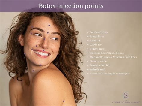 What Is Botox And How Long Does It Last The Cosmetic Skin Clinic