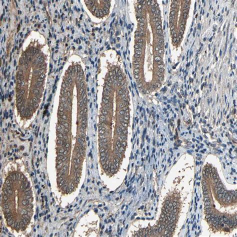 Anti Pnpla7 Human Protein Atlas Antibody