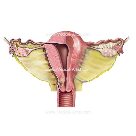 Uterus Anatomy Pictures Medical Image Search 30 Thousand Uterus