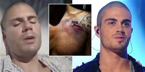 Max George 36 Delivers Huge Health Update After Urgent The Wanted
